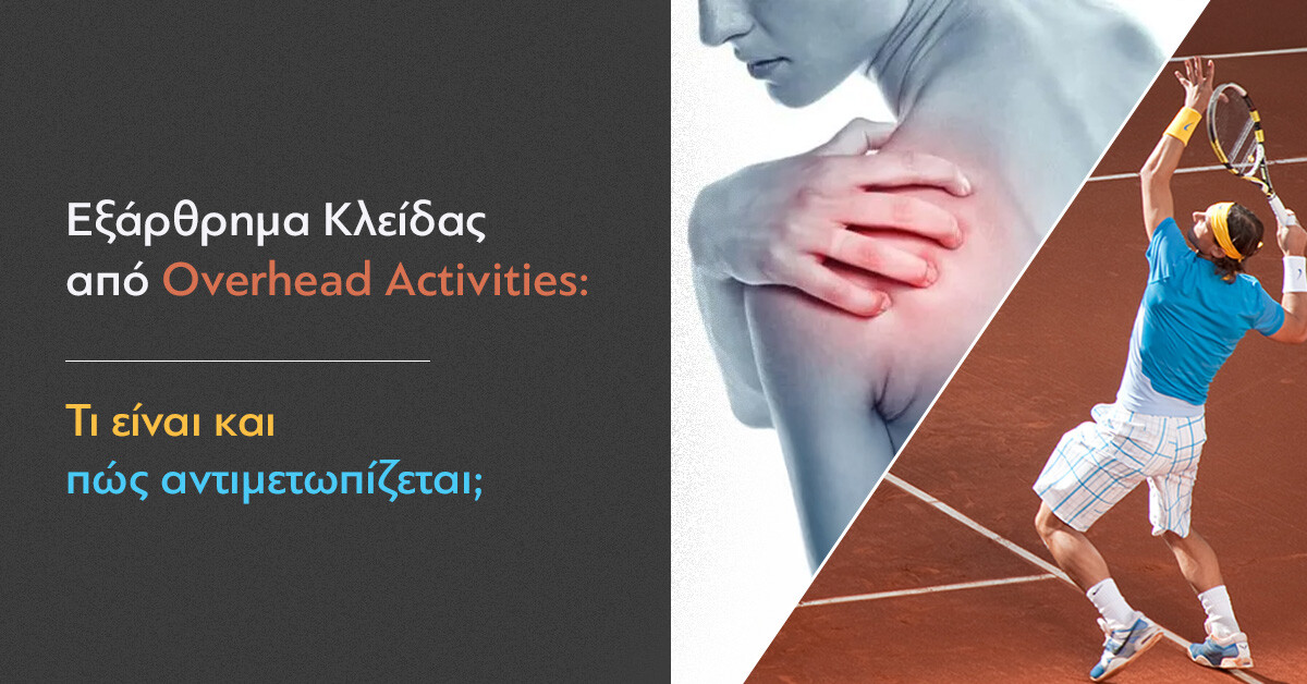 Εξάρθρημα κλείδας από overhead activities | Χιώτης Ν. Ιωάννης